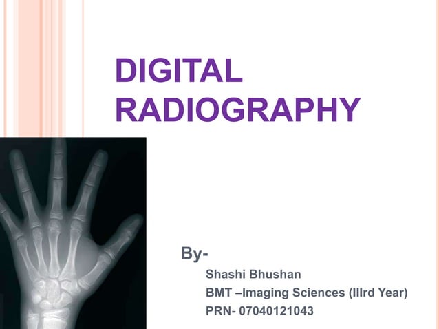 computed and digital radiography(2) | PPTX