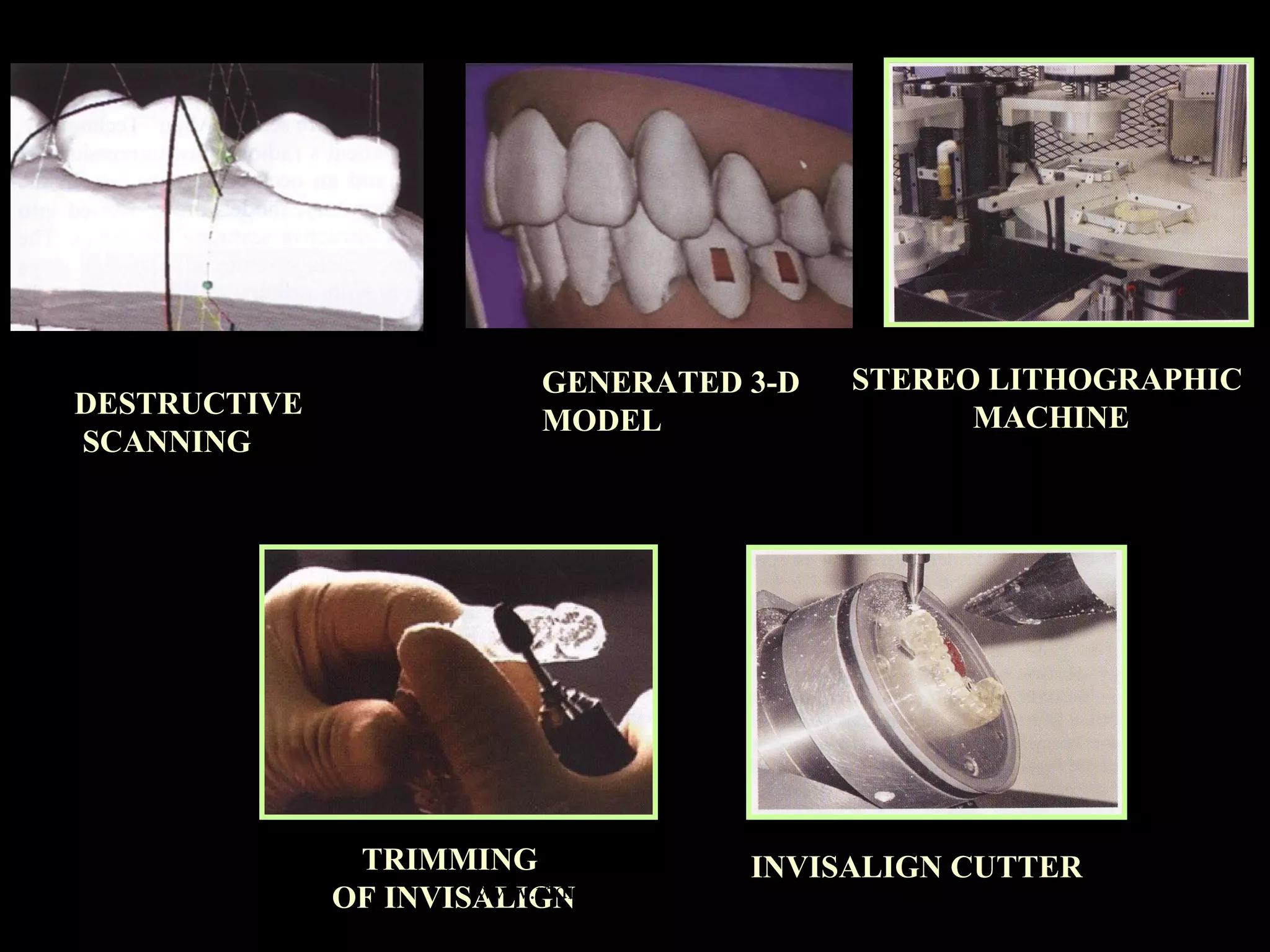 Digital imaging in orthodontics | PPT