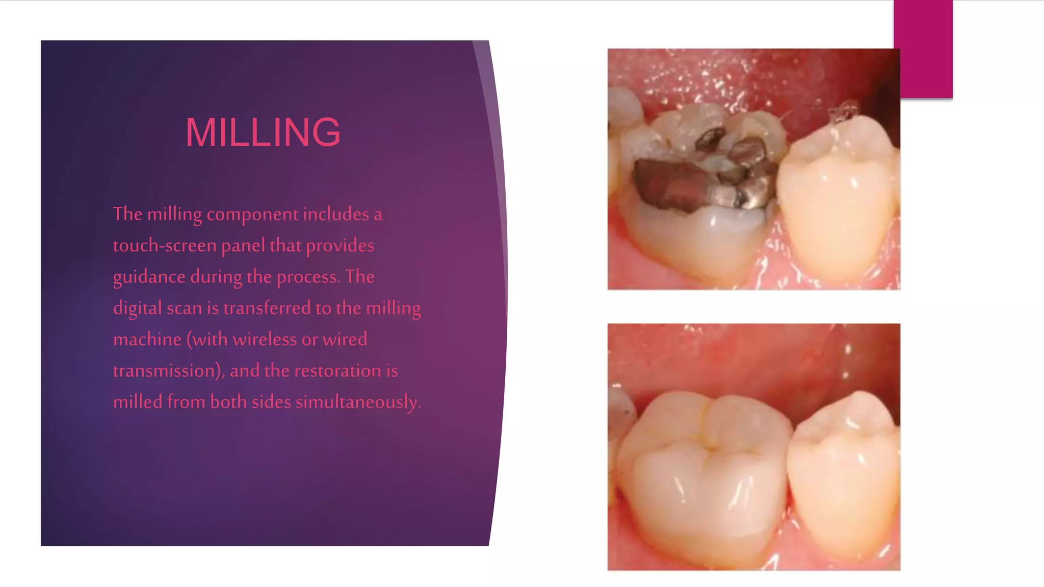 Digital impressions | PPTX