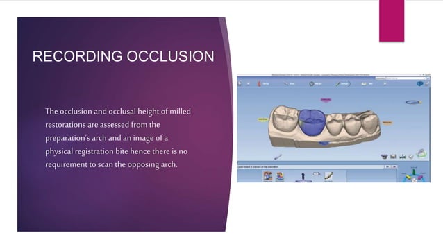 Digital impressions | PPTX