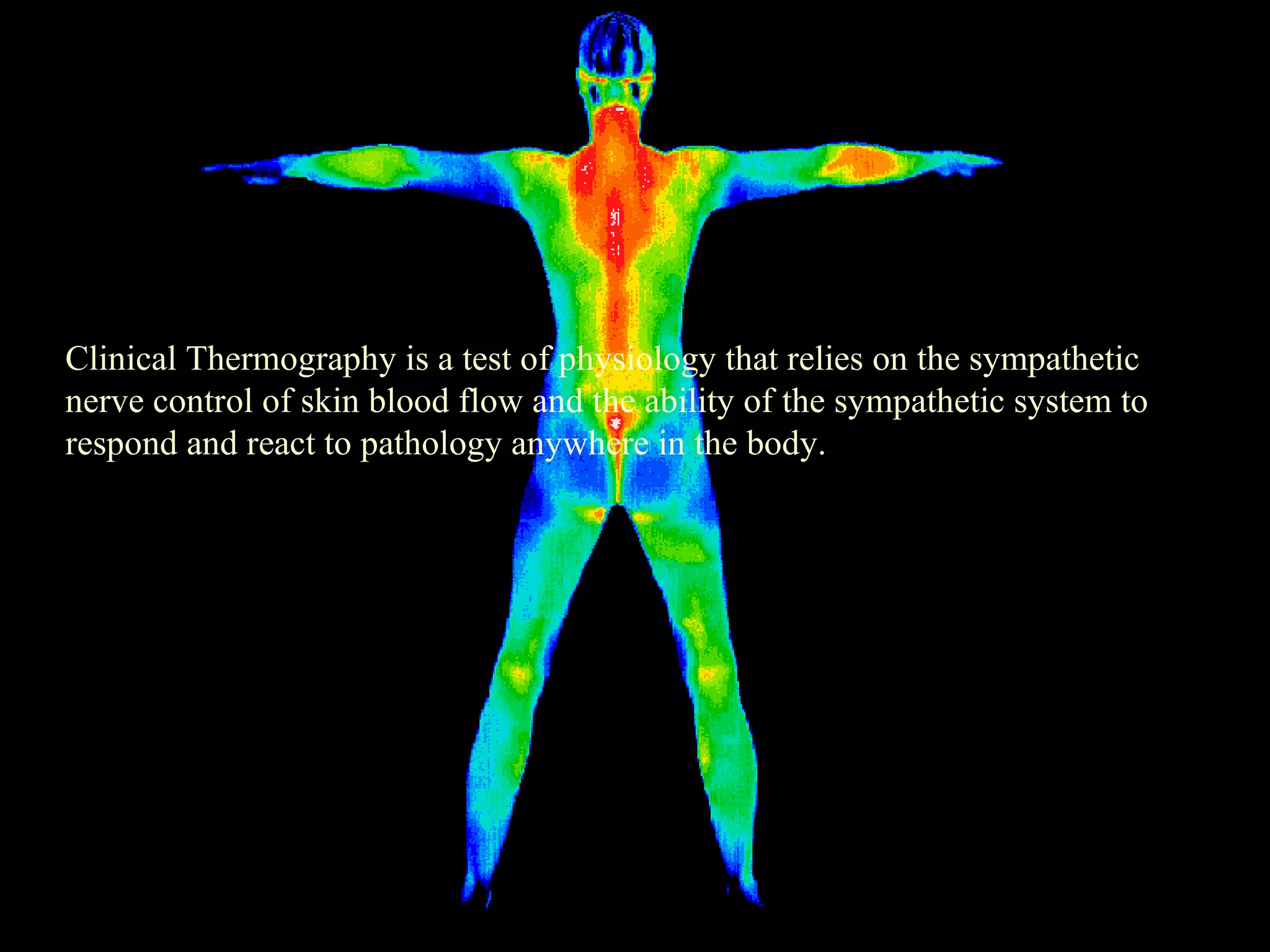 Digital Infrared Thermal Imaging | PPT