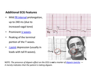 DIGITALIS GLYCOSIDE TOXICITY ED management | PPTX | Heart and ...