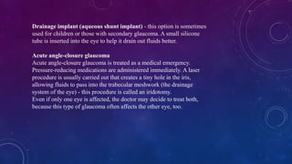 Glaucoma | PPT