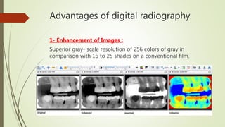 Digital oral radiography | PPT