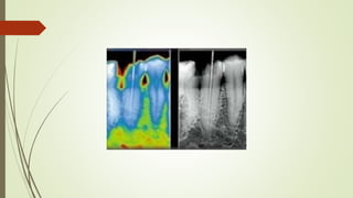 Digital oral radiography | PPT
