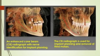 Digital oral radiography | PPT