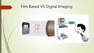 Digital oral radiography | PPT