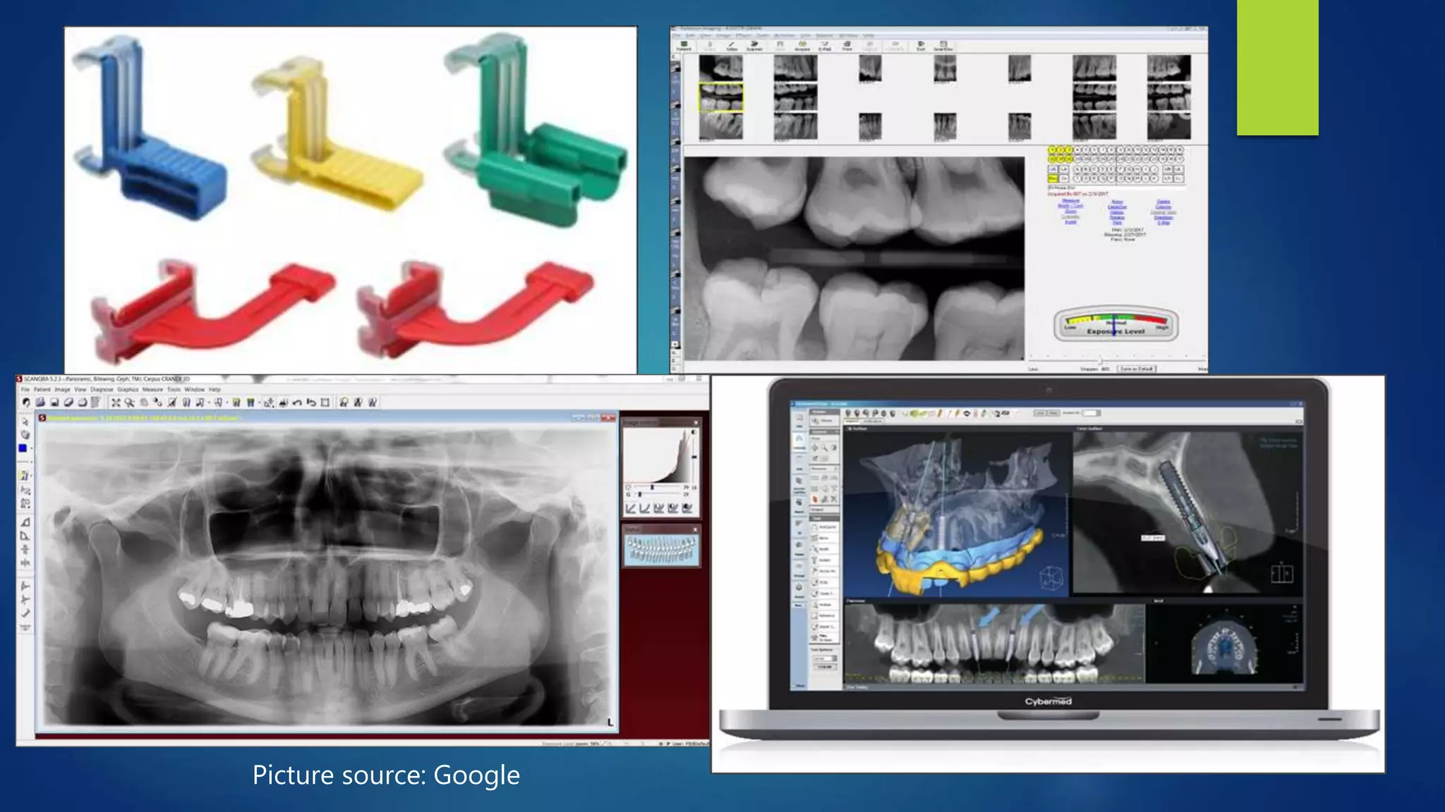 Digital orthodontics | PPTX