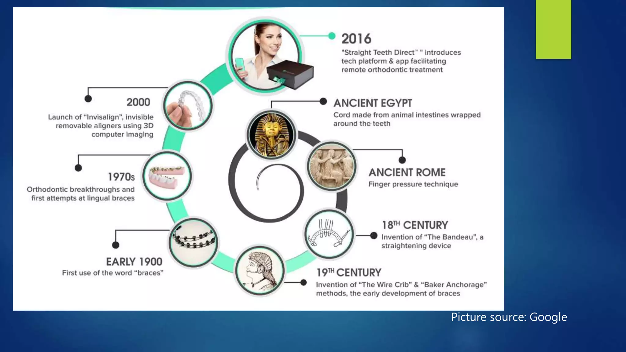 Digital orthodontics | PPTX