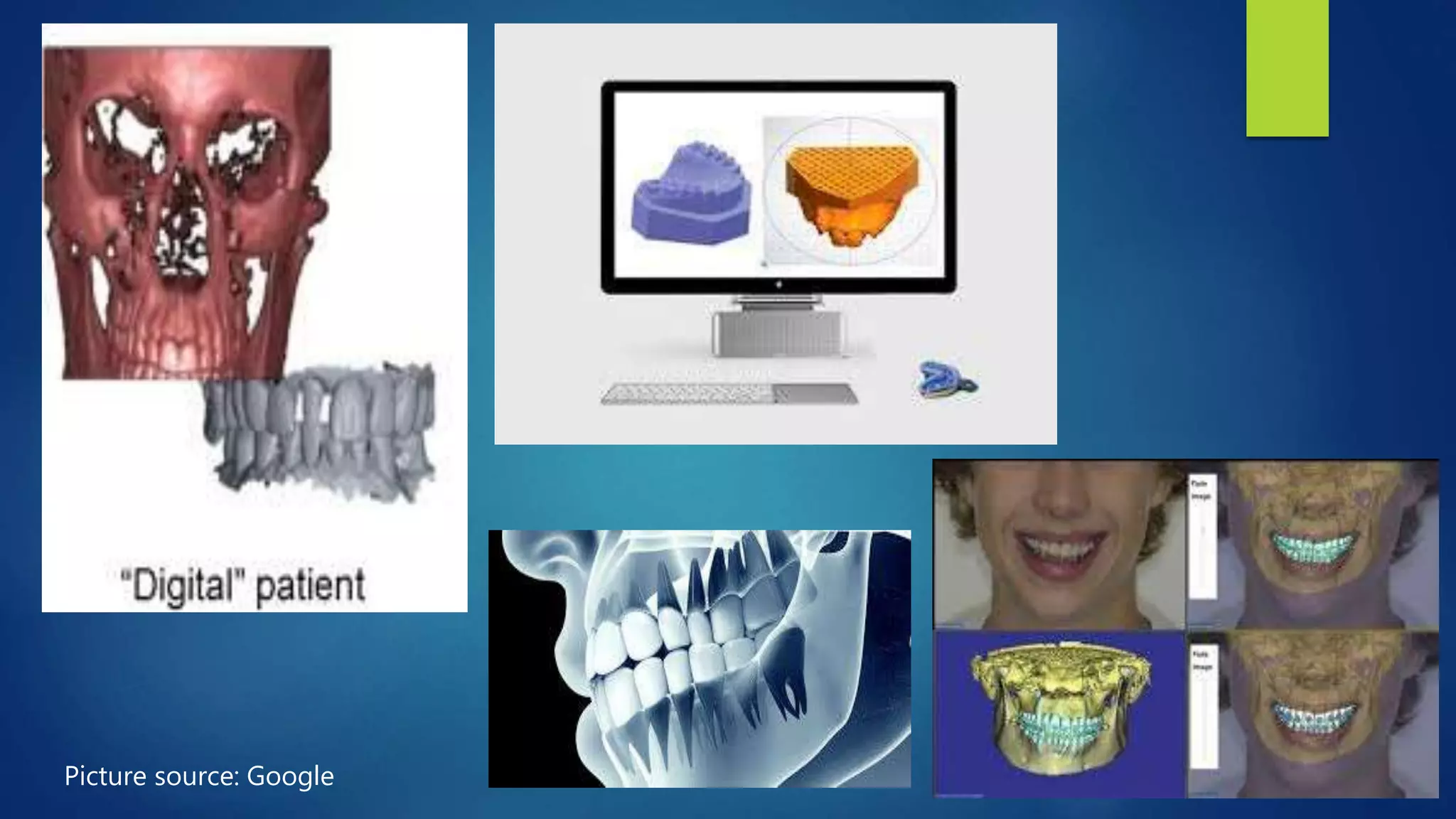 Digital orthodontics | PPTX