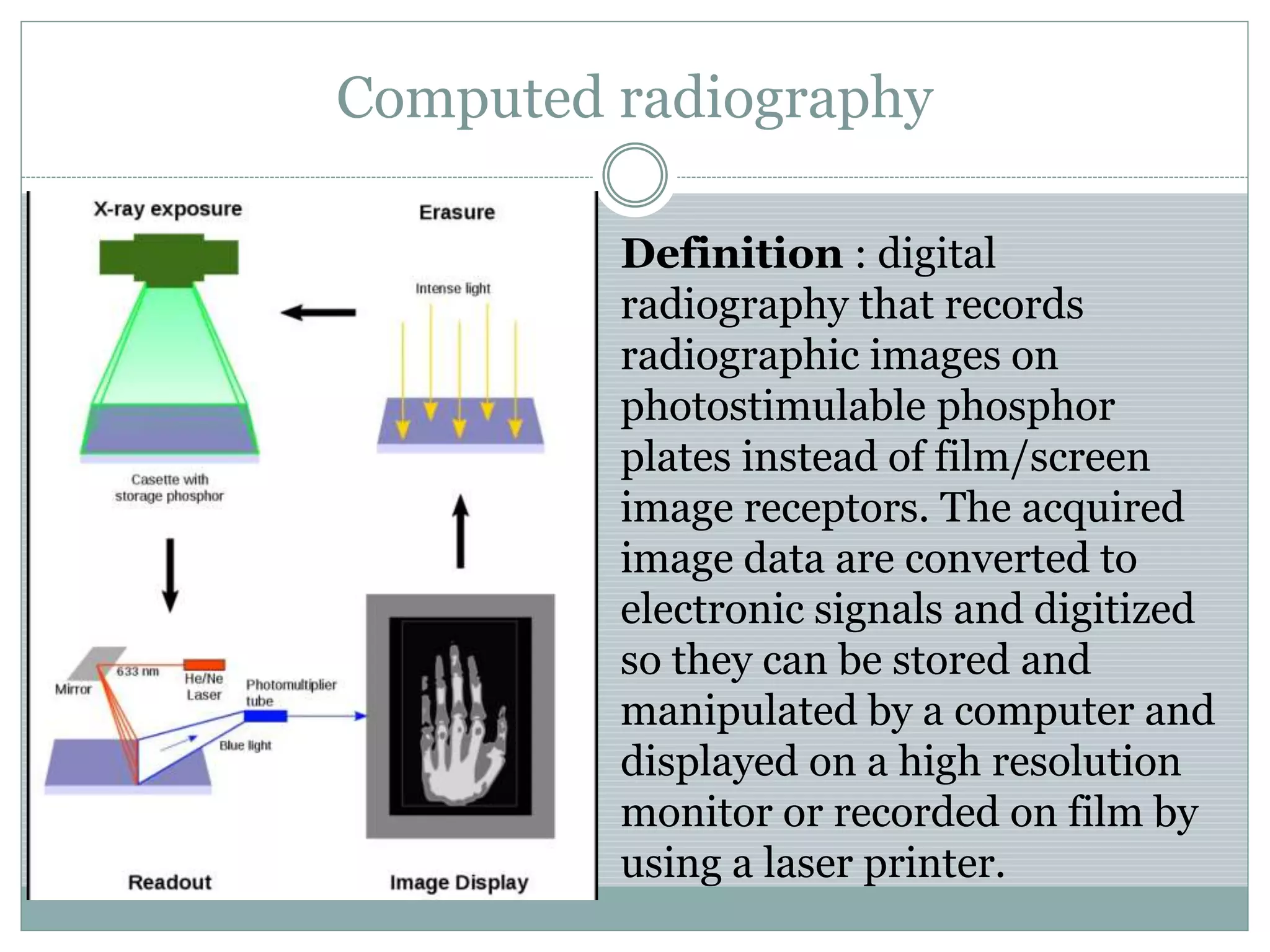Digital radiography | PPTX