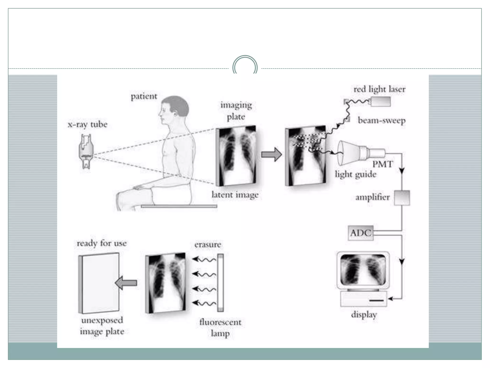 Digital radiography | PPTX