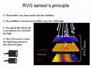 digital radiography in Dentistry: Direct and Indirect Technology | PPT