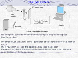 digital radiography in Dentistry: Direct and Indirect Technology | PPT