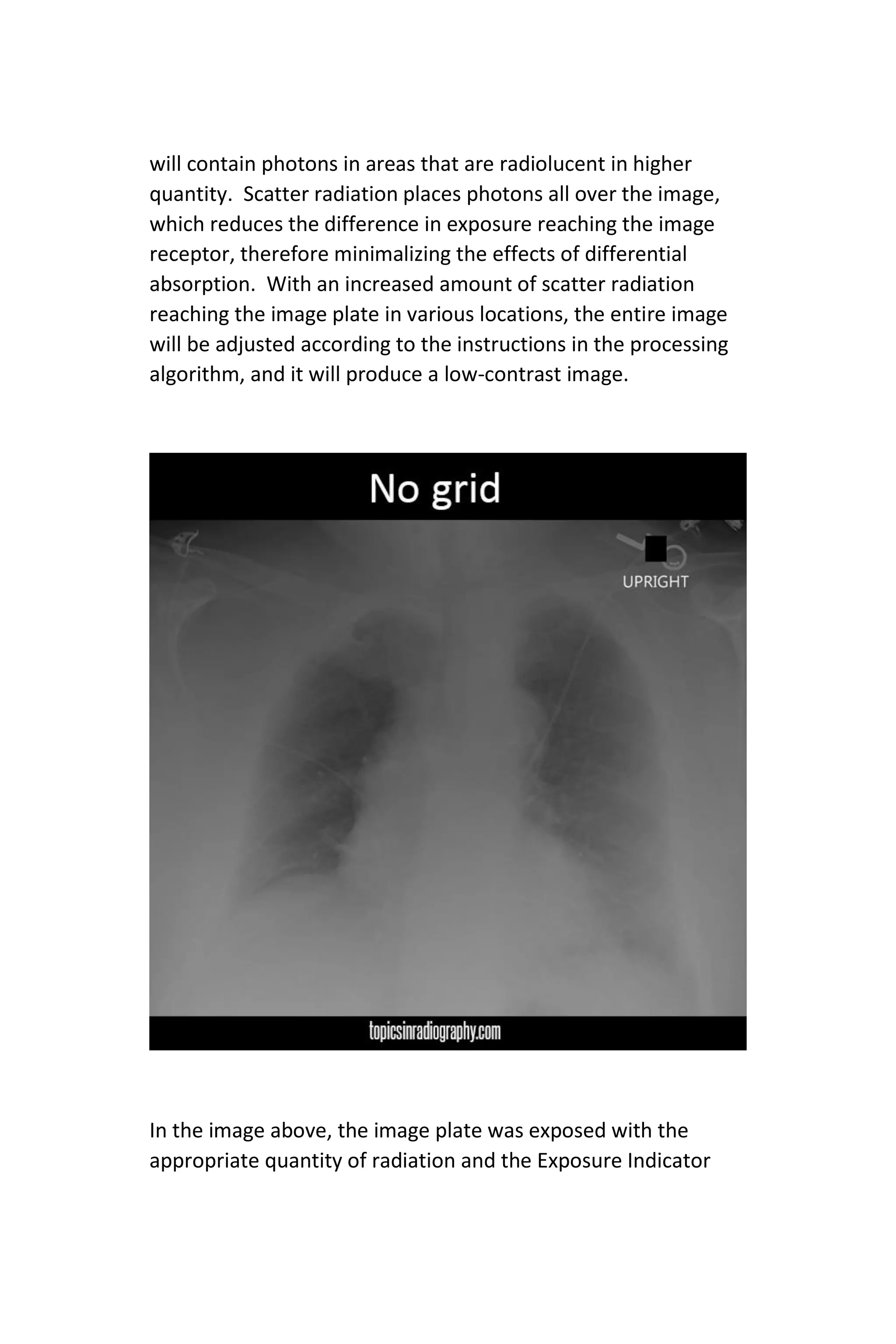 Digital Radiography Image Critique | PDF