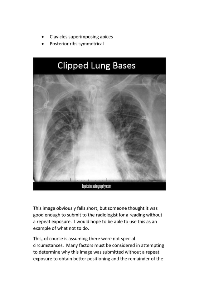 Digital Radiography Image Critique | PDF