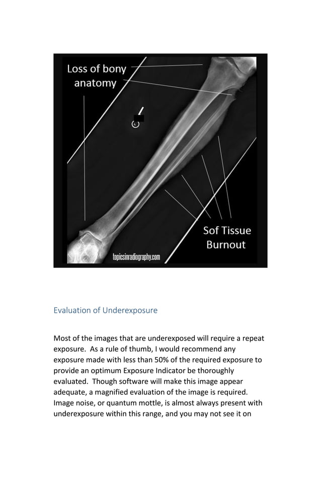 Digital Radiography Image Critique | PDF