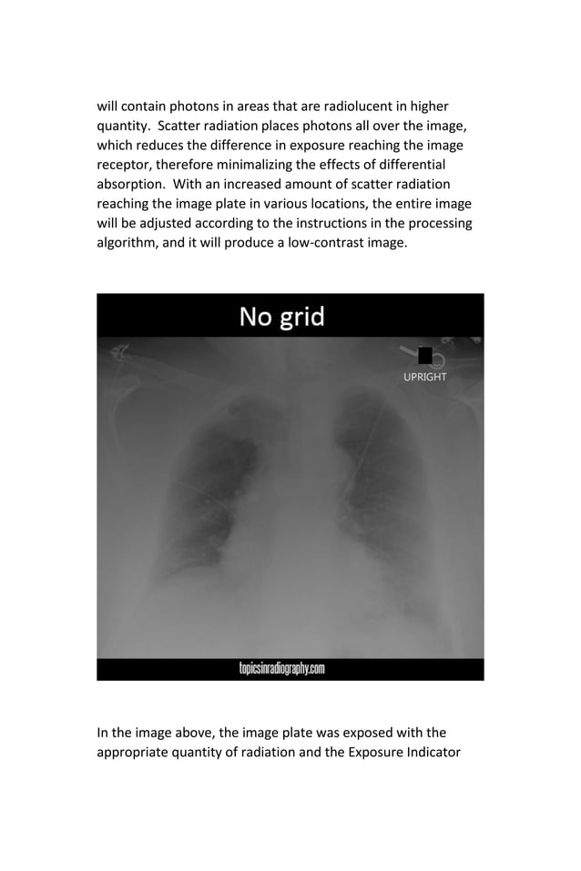 Digital Radiography Image Critique | PDF