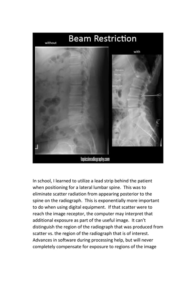 Digital Radiography Image Critique | PDF