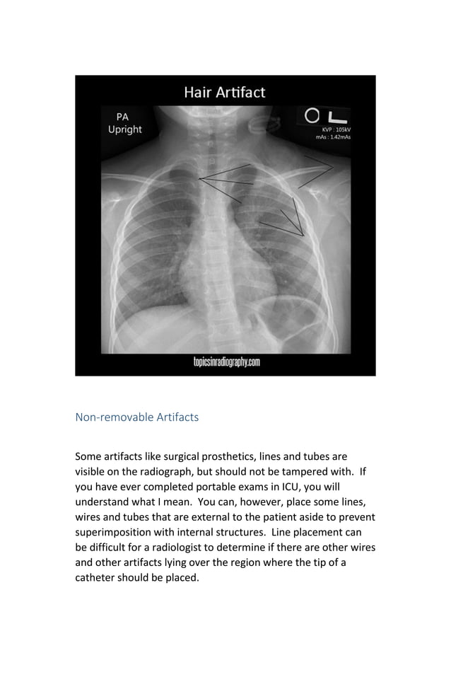 Digital Radiography Image Critique | PDF