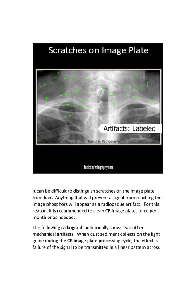Digital Radiography Image Critique | PDF