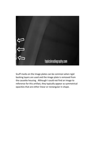 Digital Radiography Image Critique | PDF