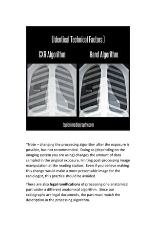Digital Radiography Image Critique | PDF