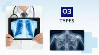 DIGITAL RADIOGRAPHY in X-RAY-1DIGITAL RADIOGRAPHY in X-RAY-1.pptx
