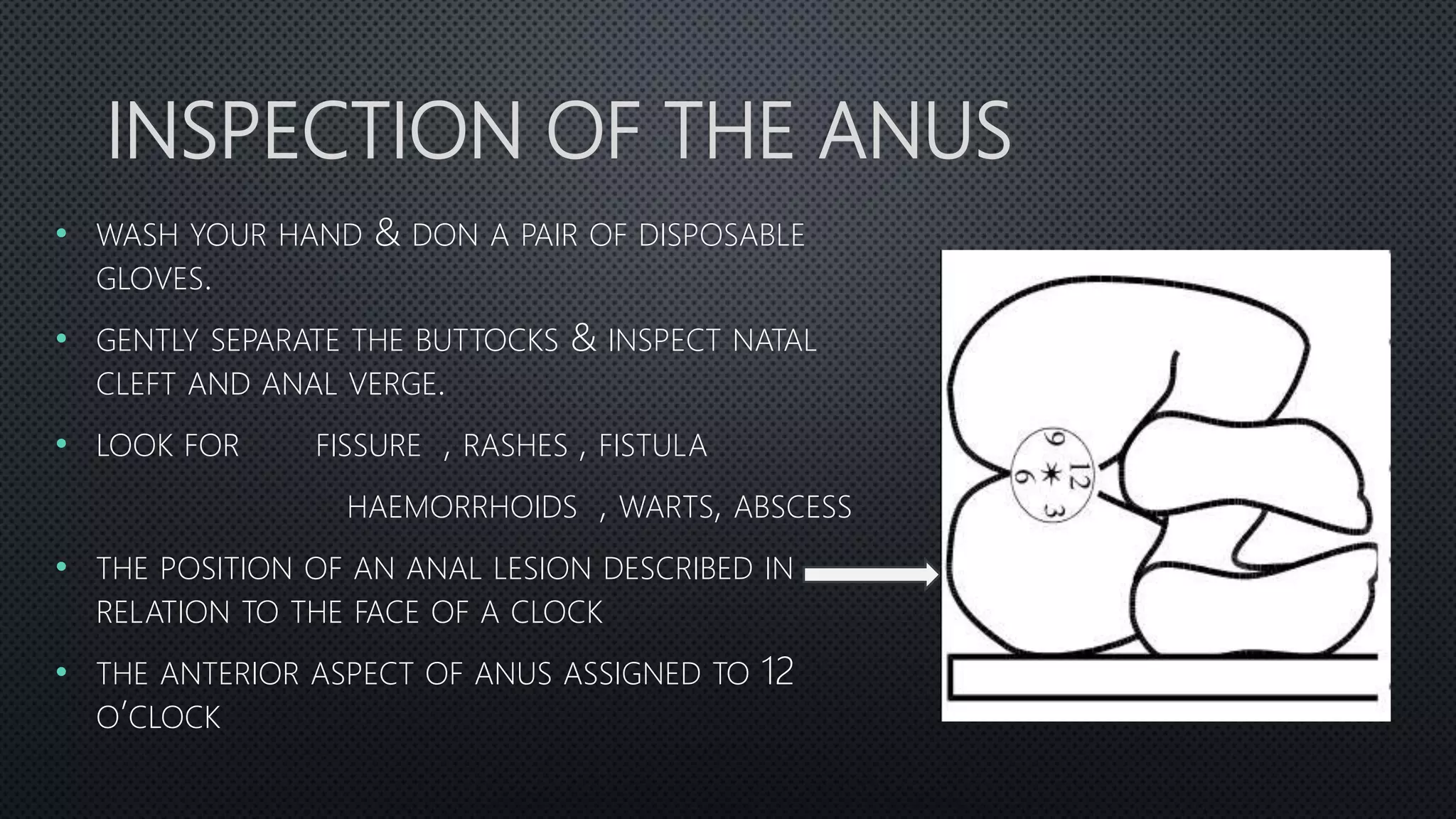 Digital Rectal Examinationpptx Ppt