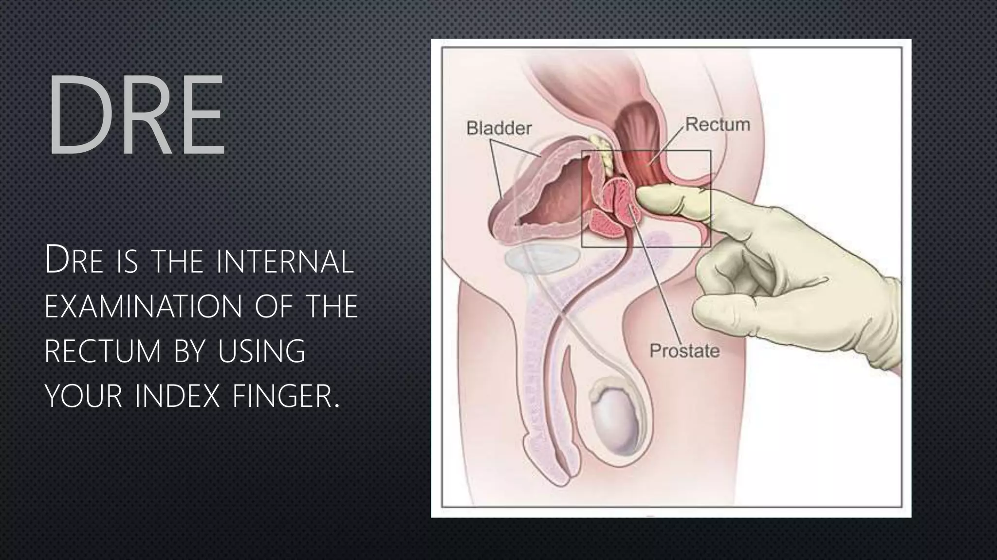 Digital rectal examination.pptx @ | PPTX