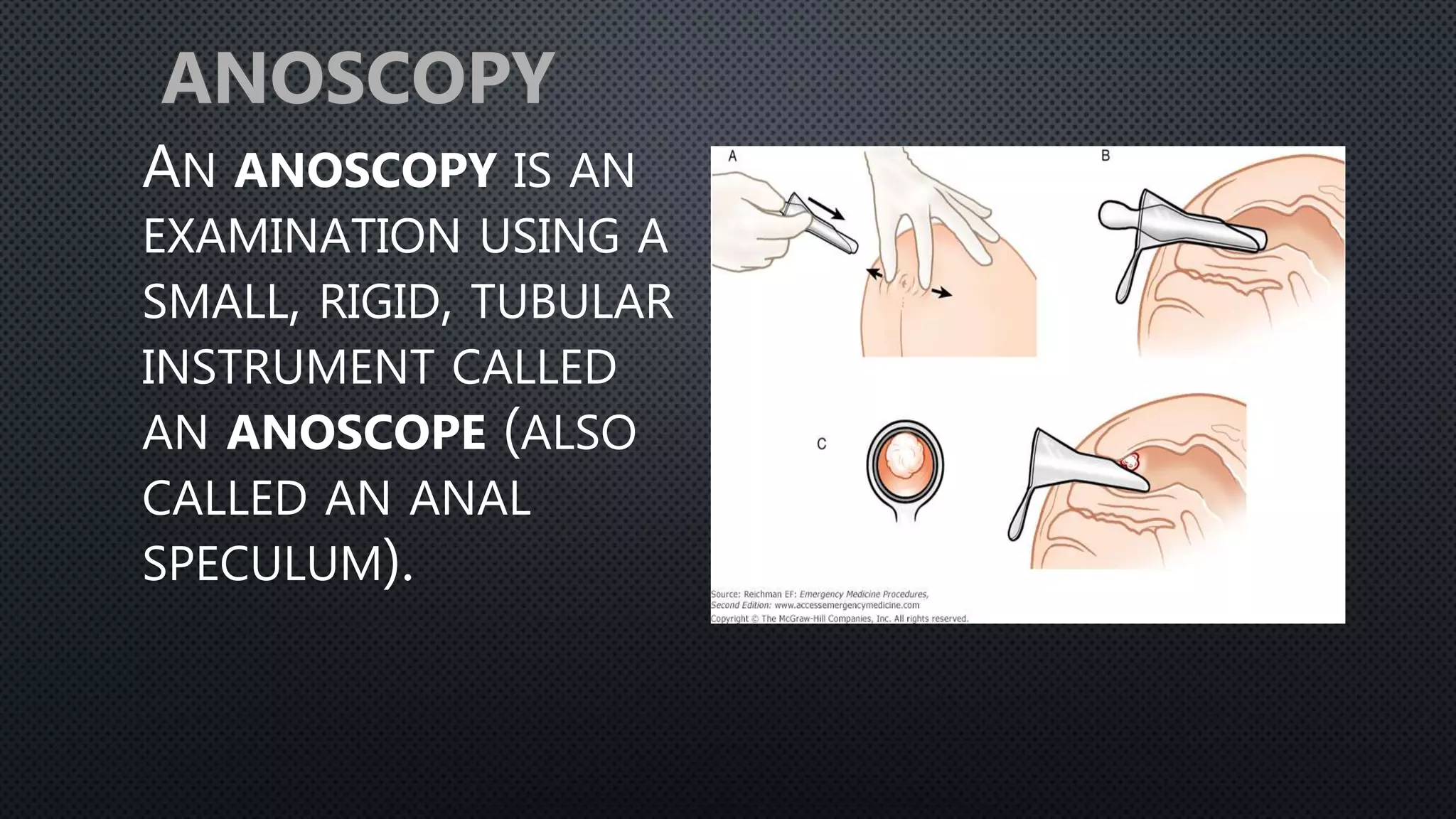 Digital rectal examination.pptx @ | PPTX