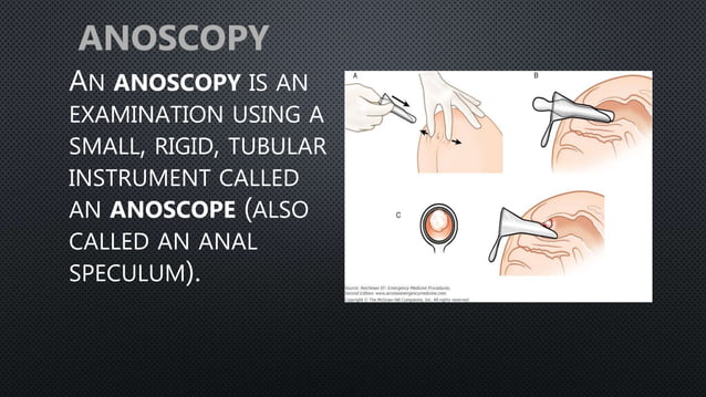 Digital rectal examination.pptx @ | PPTX | Digestive Disorders ...