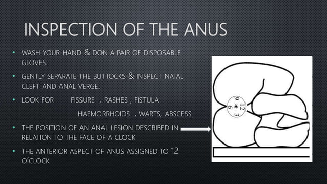 Digital rectal examination.pptx