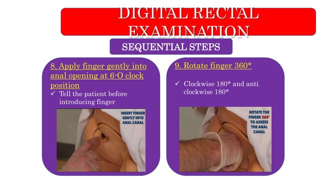 Digital rectal examination/Skill lab/ OSCE | PPT