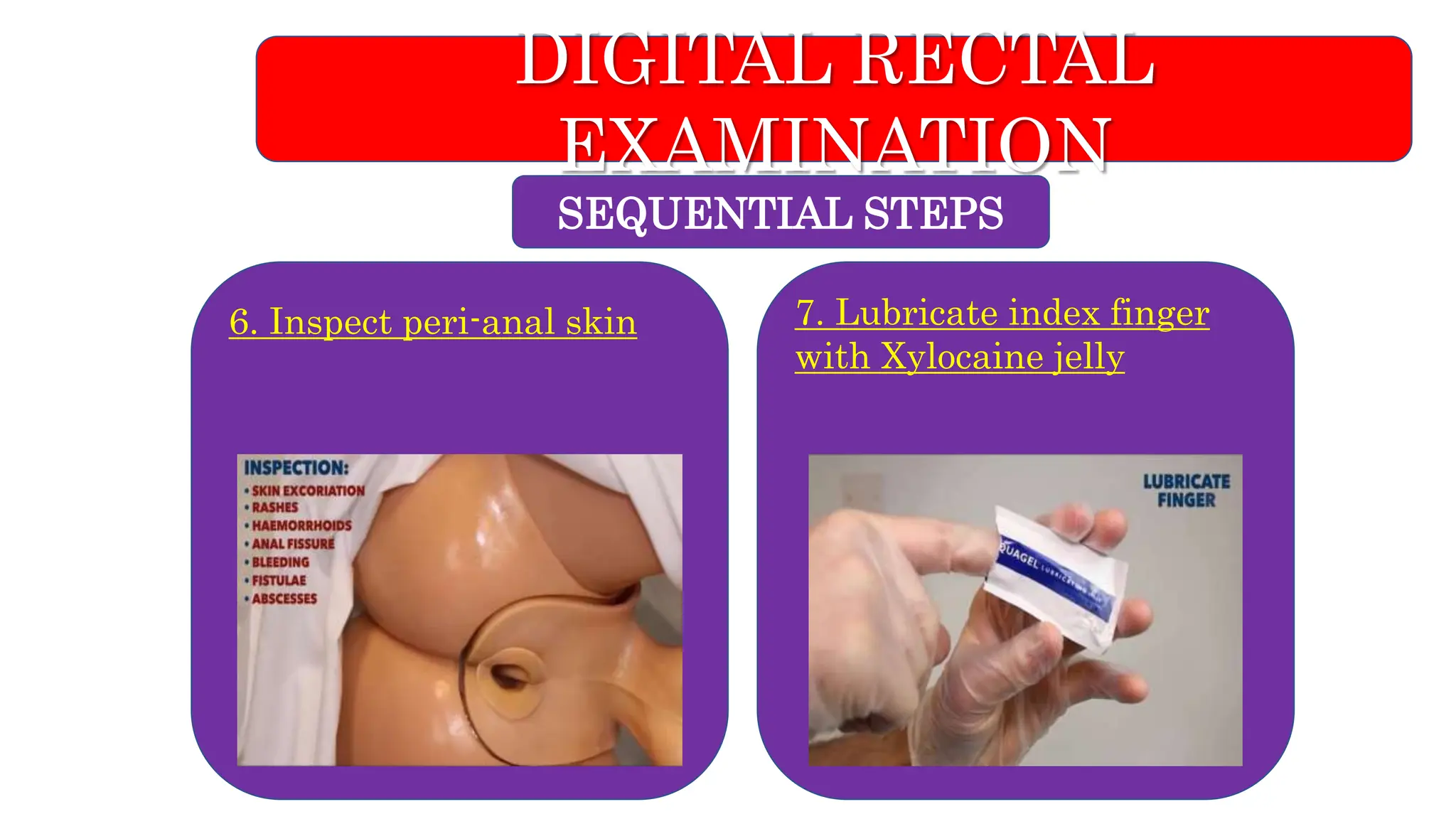 digitalrectalexamination-201219103540 2.pdf