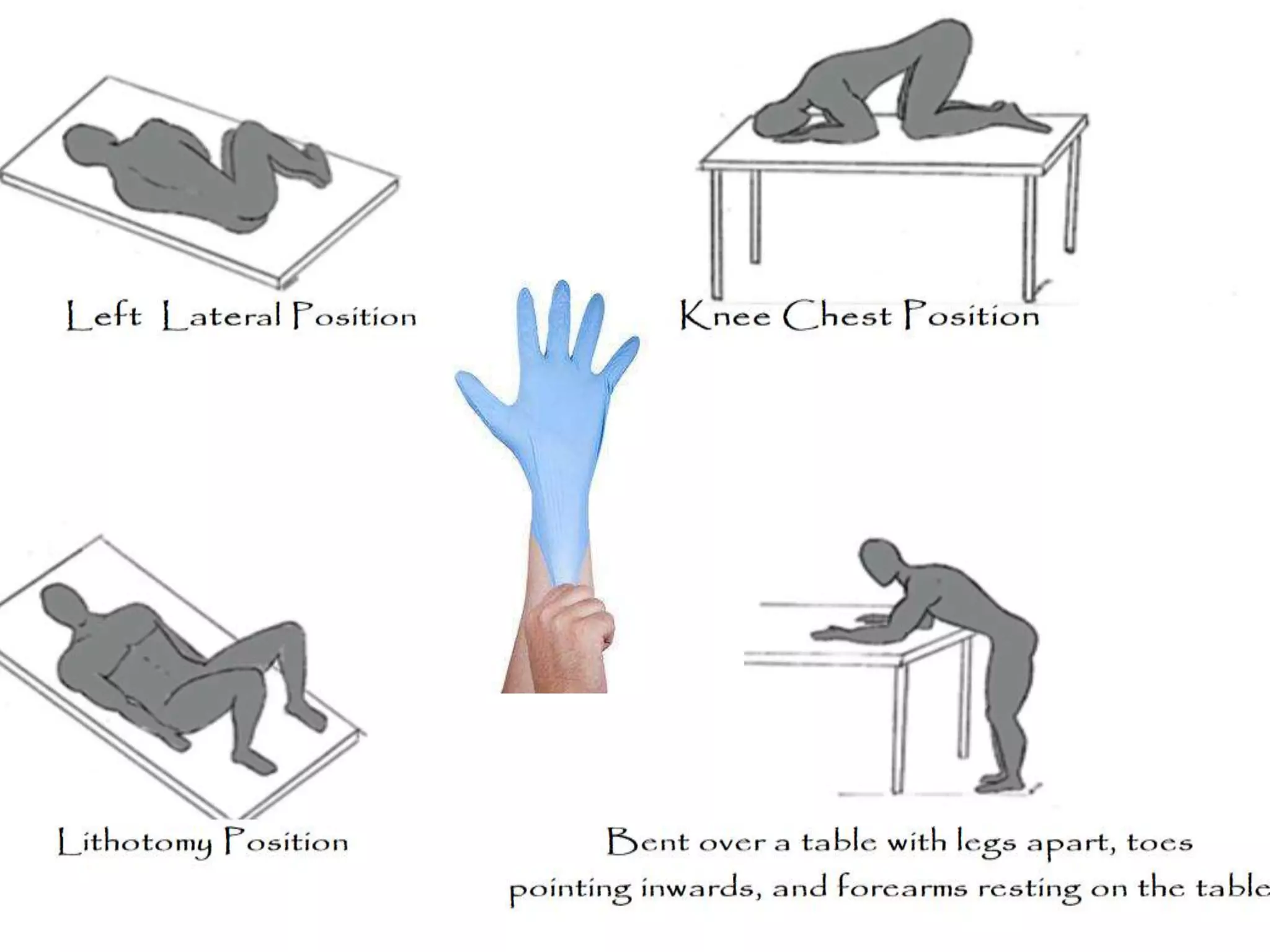 Digital Rectal Examination for Surgical Trainees | PPT