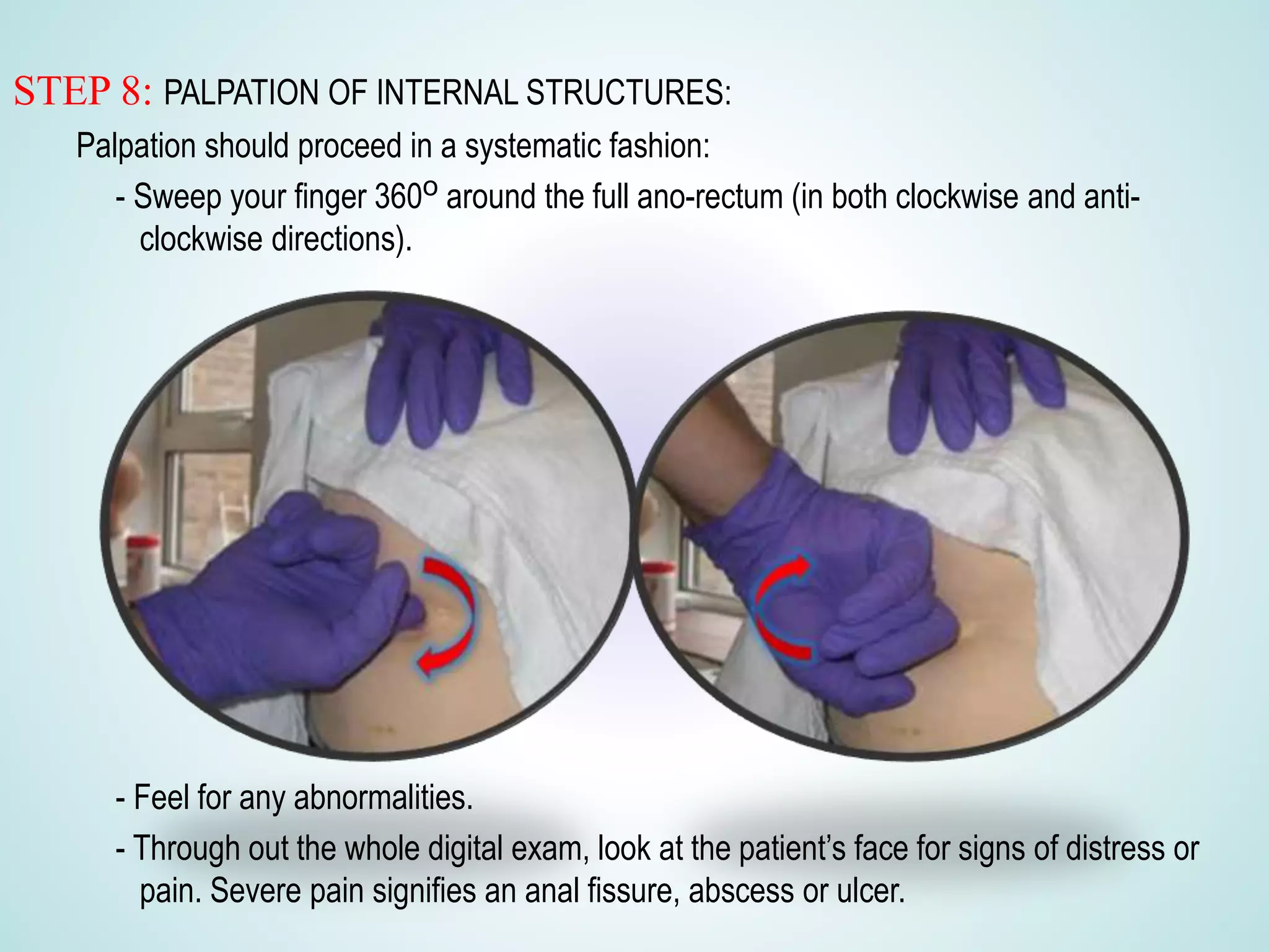 Digital Rectal Examination for Surgical Trainees | PPT