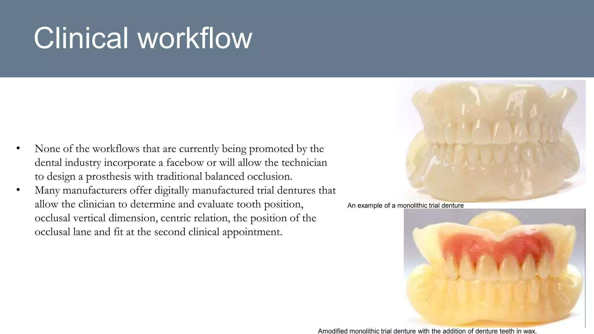 Digital Removable Complete Denture—an Overview.pptx