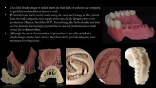 Digital Removable Complete Denture—an Overview.pptx