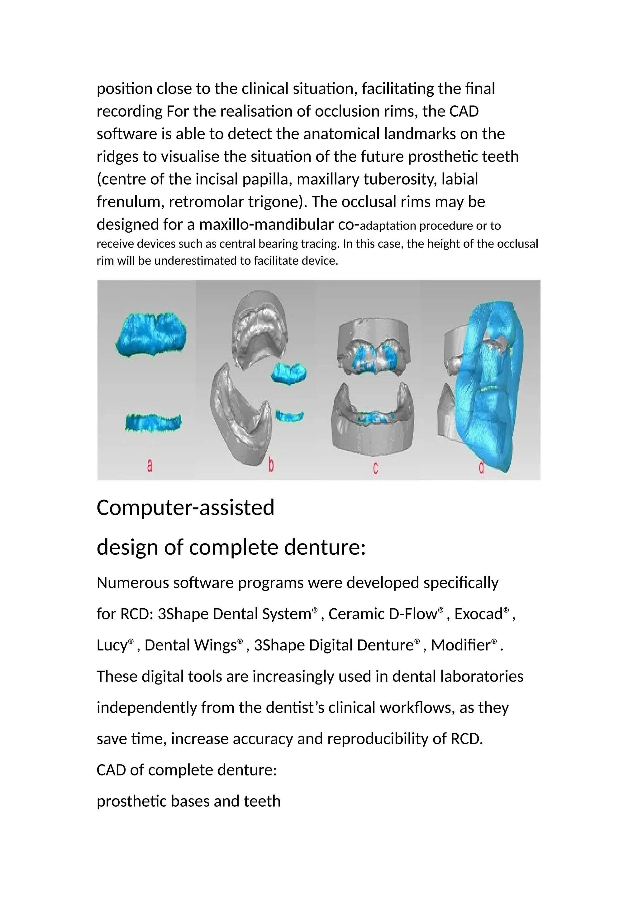 Digital removable complete dentures.docx