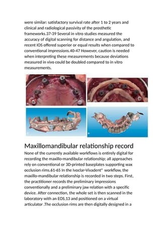 Digital removable complete dentures.docx