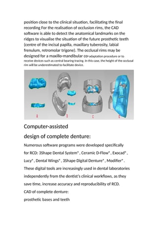 Digital removable complete dentures.docx