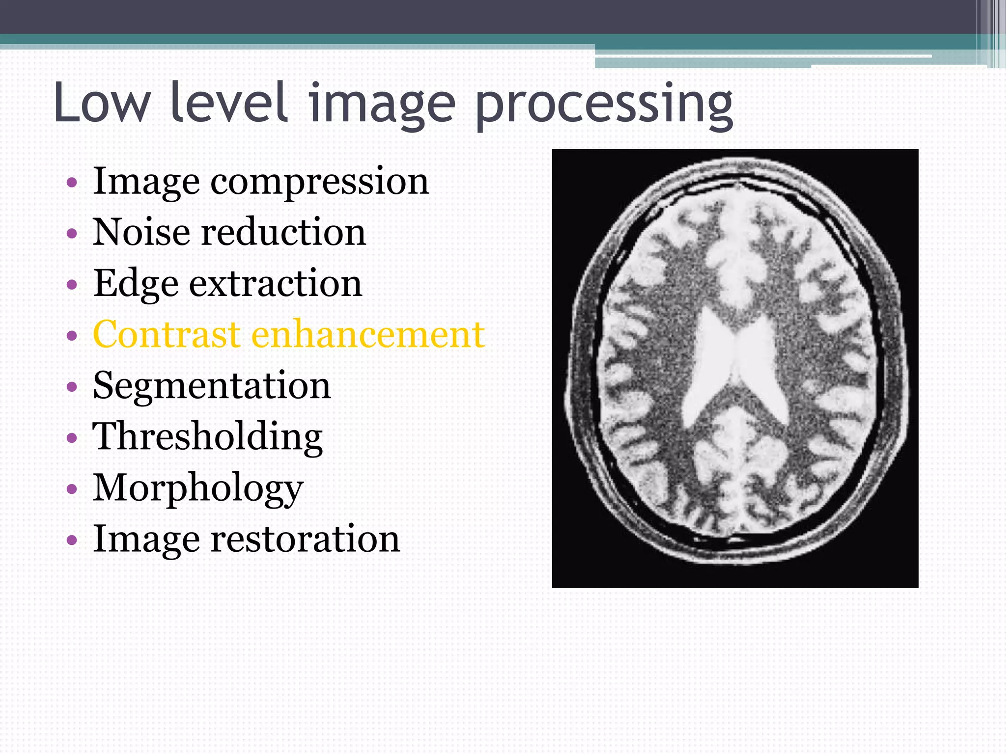 DIGITAL_SIGNAL_AND_IMAGE_PROCESSING_USIN.pptx