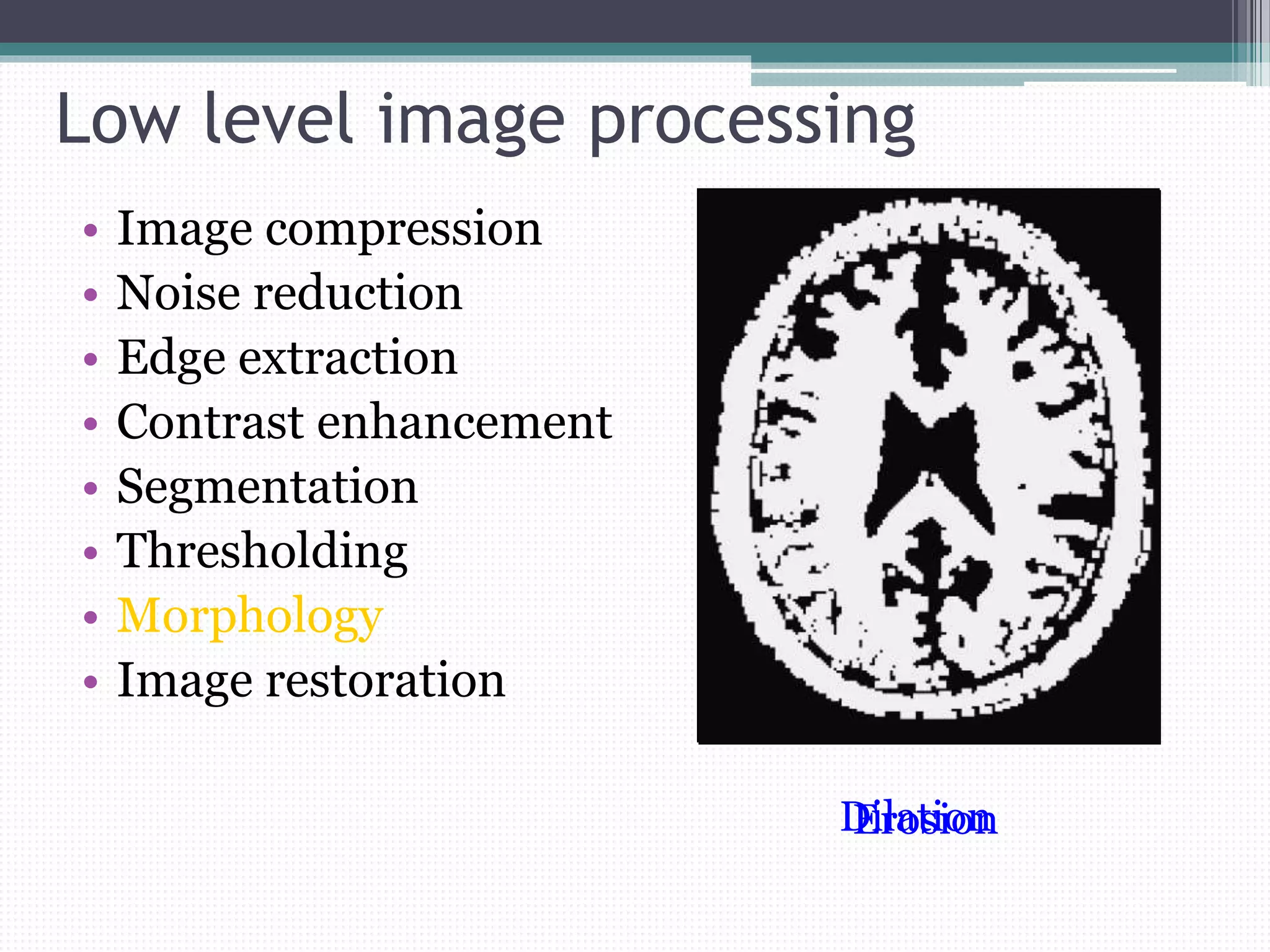 DIGITAL_SIGNAL_AND_IMAGE_PROCESSING_USIN.pptx