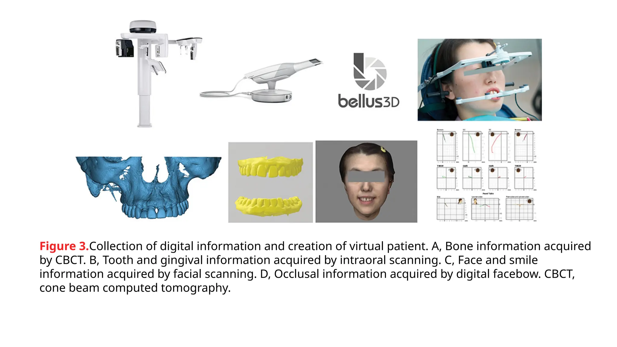 digital smile designing for study purpose | PPTX
