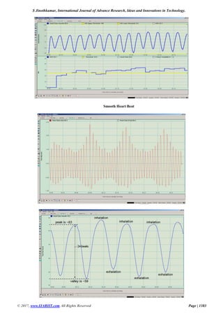 Digital stethoscope a new approach to know and hear heart beat and ...