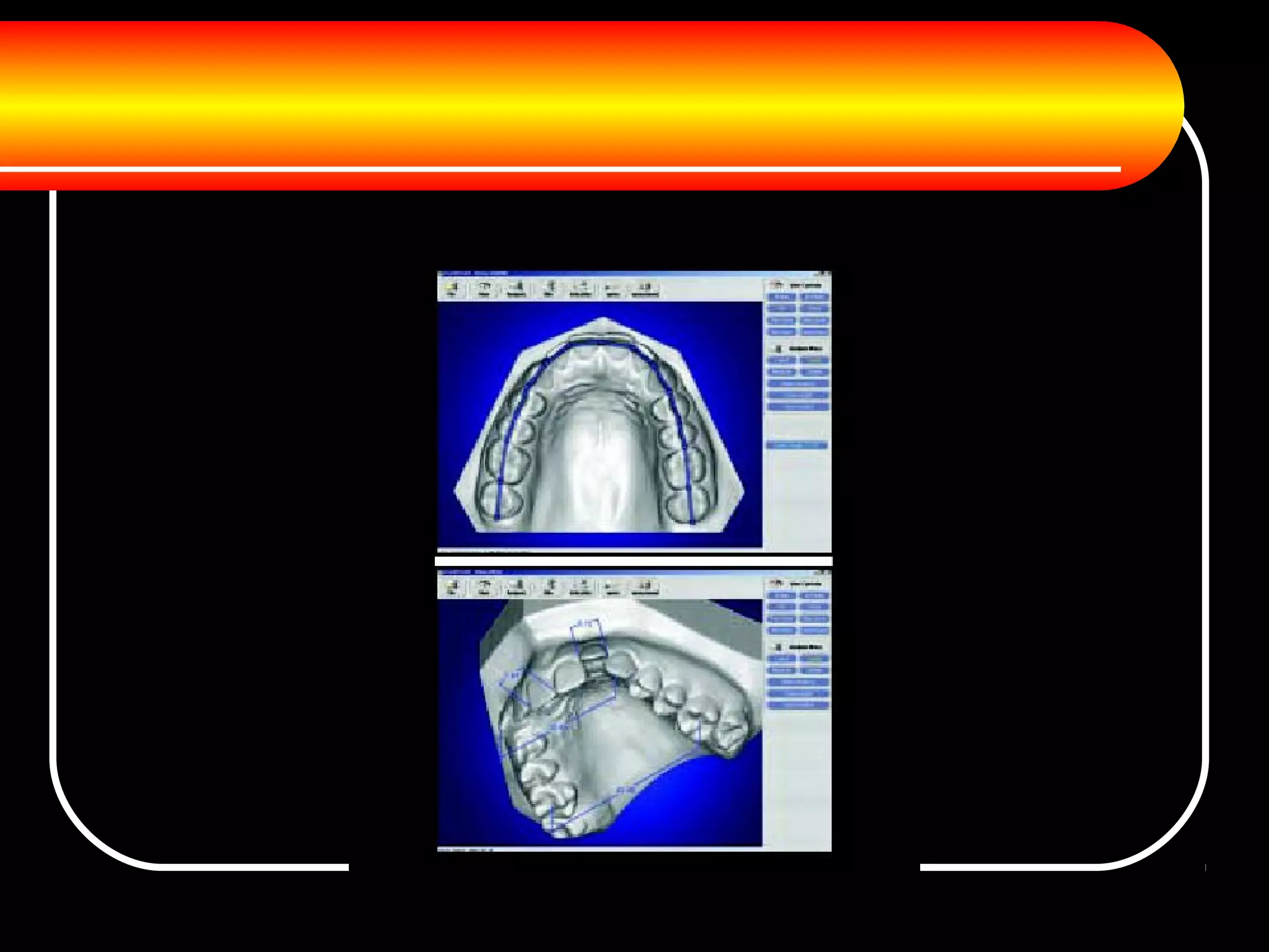 Digital study models | PPT