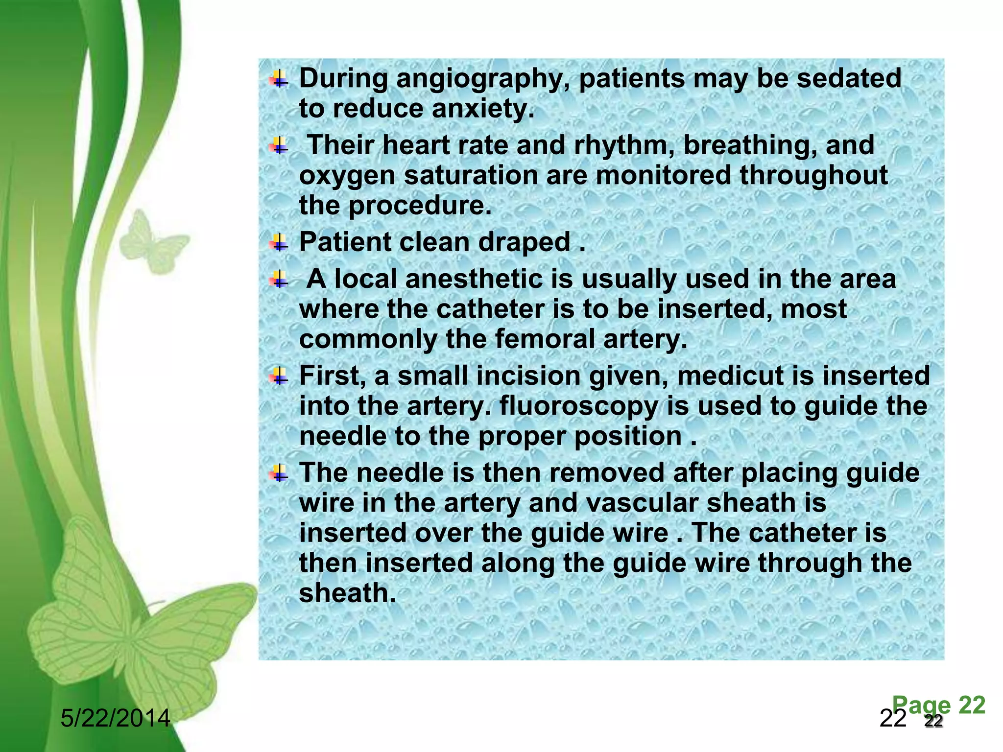 Digital subtraction angiography | PPTX