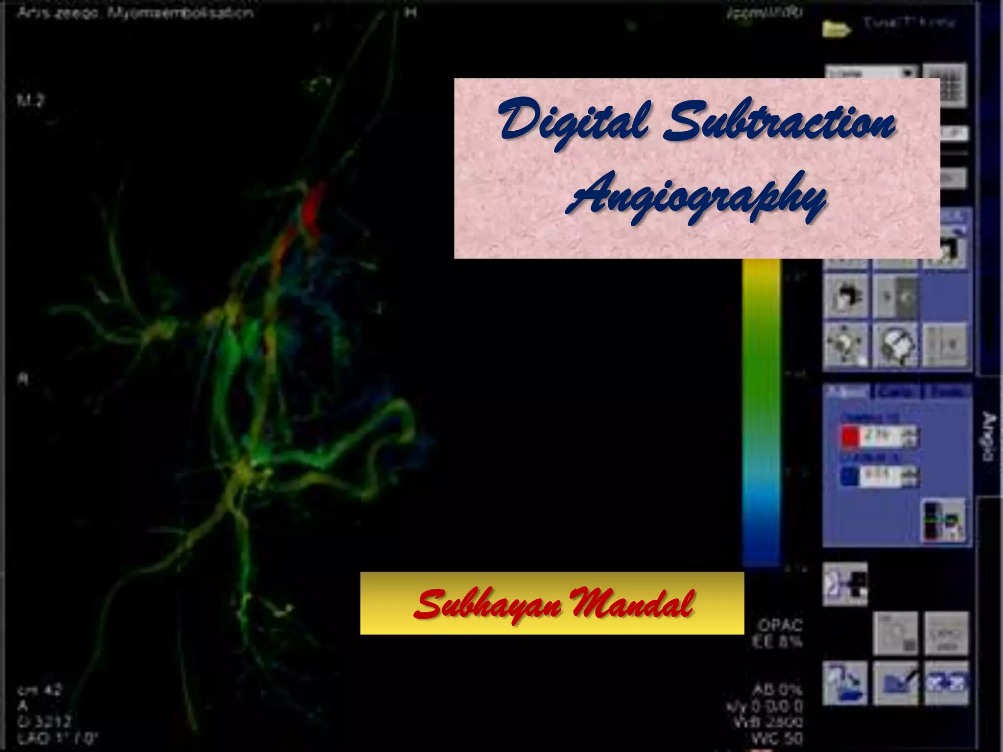 Digital subtraction angiography | PPT