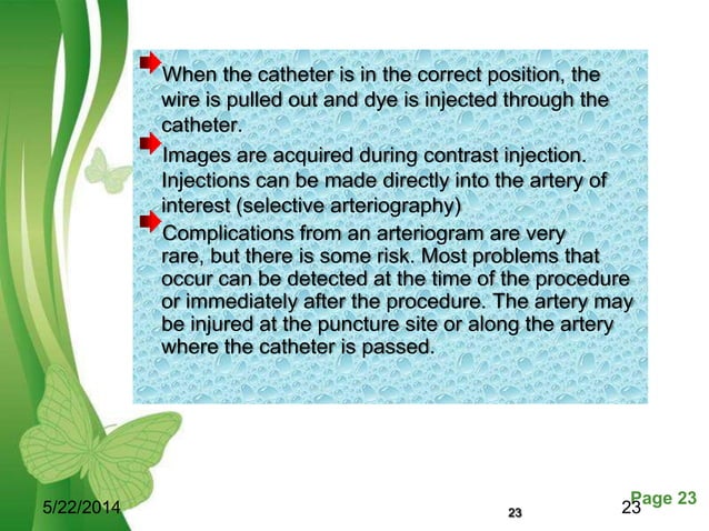 Digital subtraction angiography | PPTX
